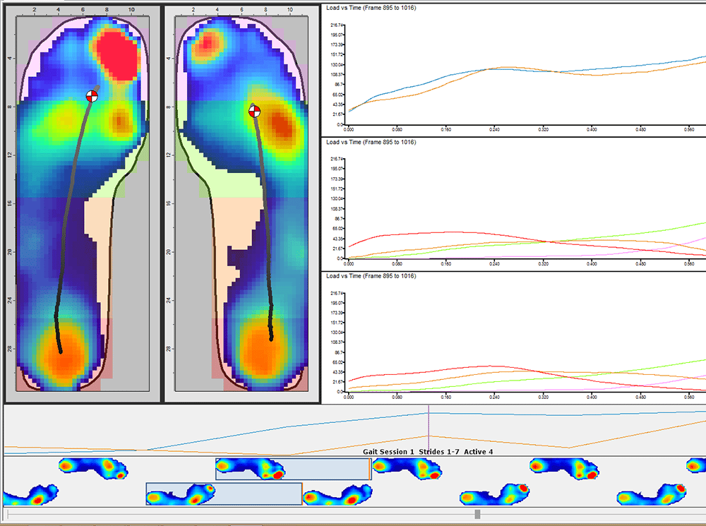 Webinar (Part 7): Sport Rehab with Insoles