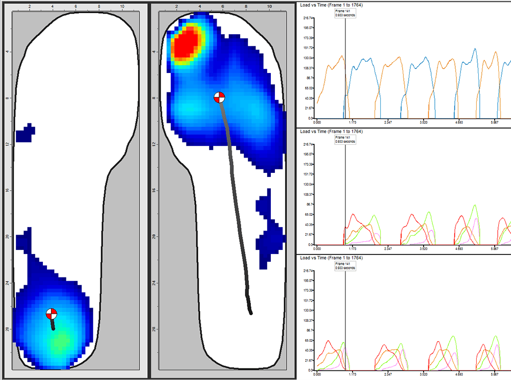 Assessing Maximum Speed in Power & Strength-Based Sports with Plantar ...