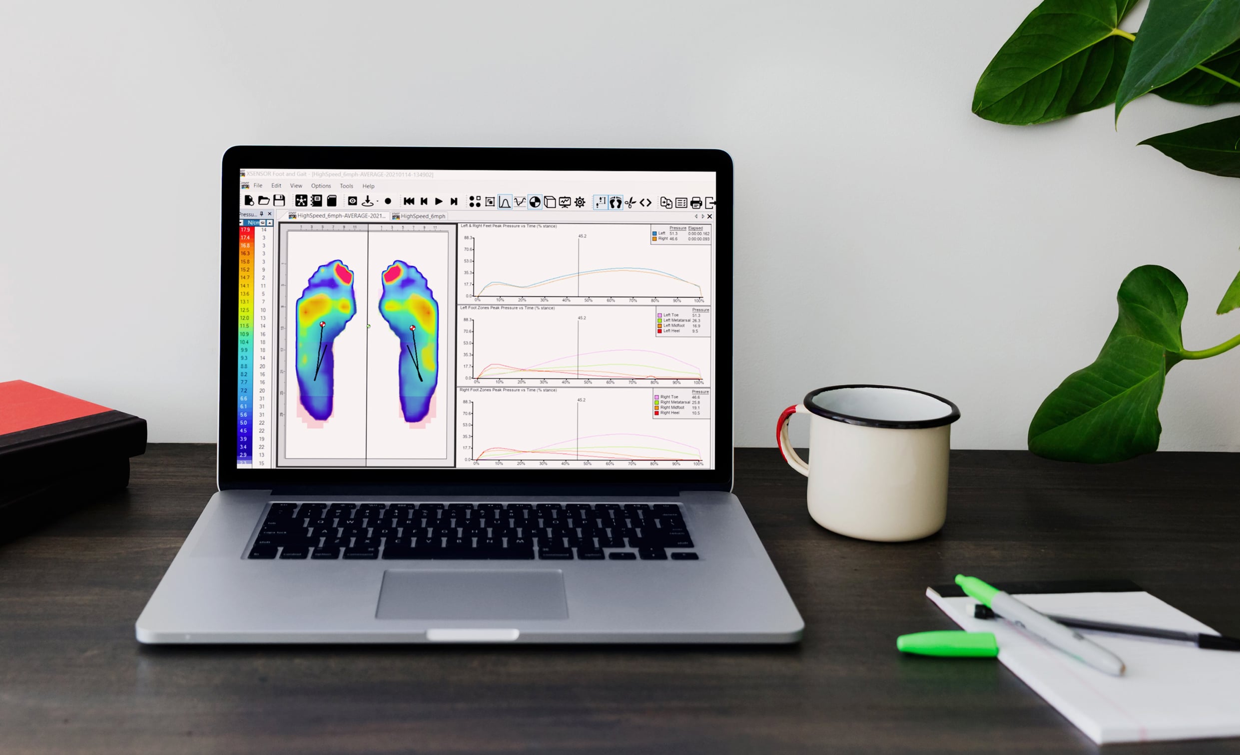 Ebook: Intro to Plantar Pressure Mapping in Sport